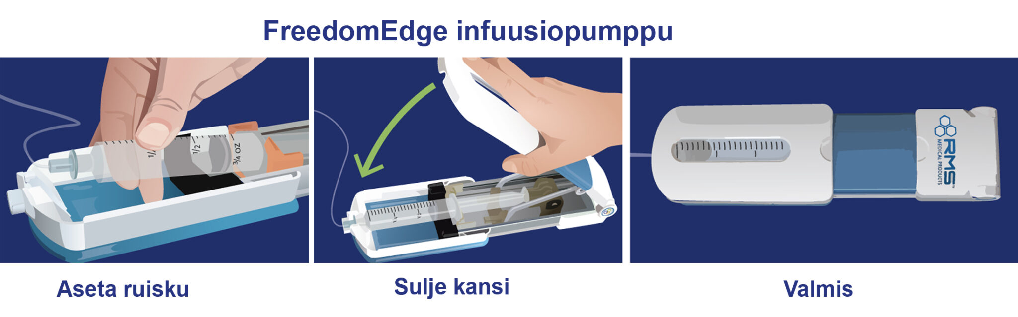 PNH:n lääkehoito ihonalaisella infuusiolla - Steripolar